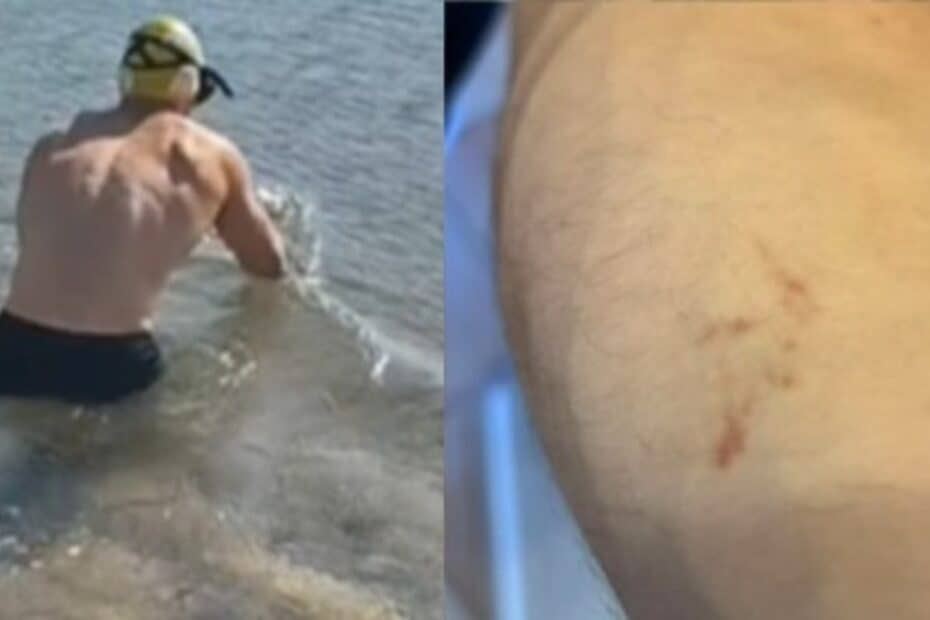 “Attaccato da uno squalo”. Choc per un turista nel mare italiano: “Mi ...